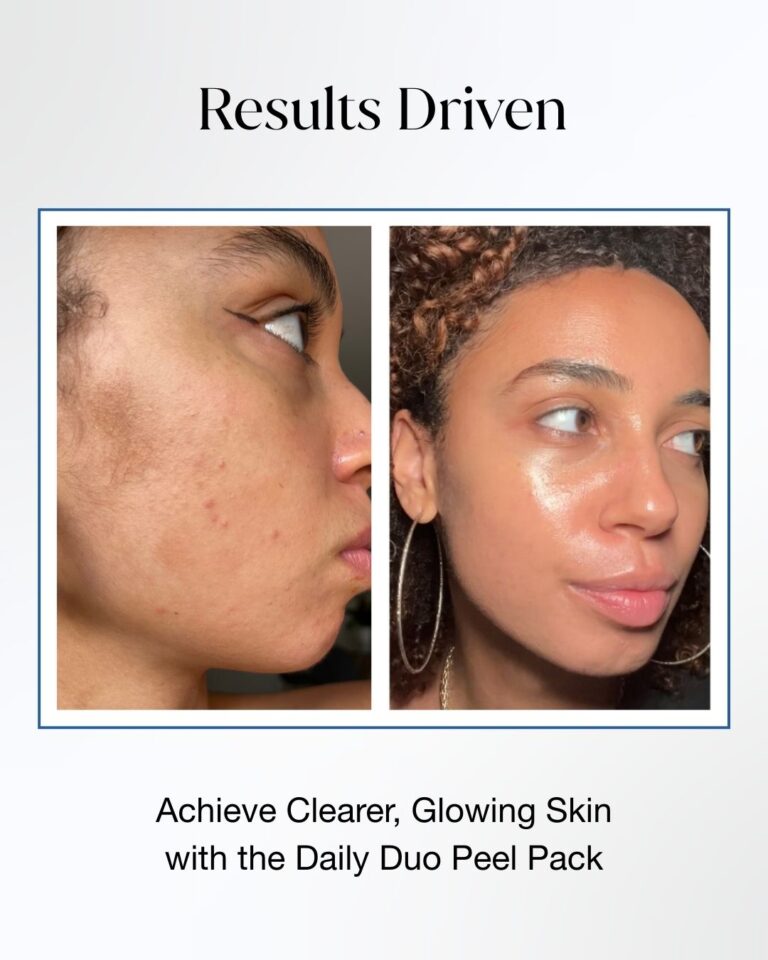 Daily Duo Peel Pack - At Home AHA/BHA Peeling Serum